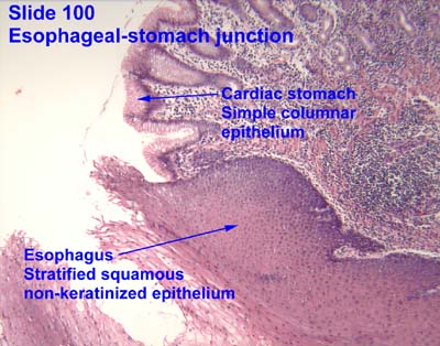 Gastroesophageal Junction Slide Labeled